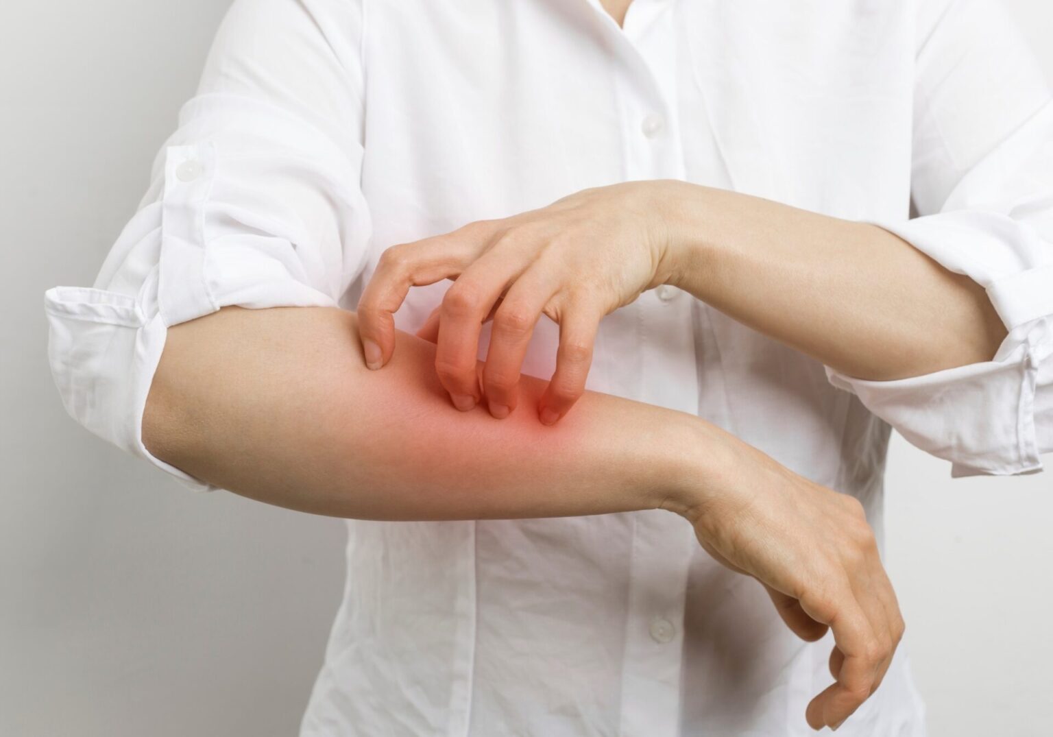 Scabies Treatment Online | Quick Symptom Relief
